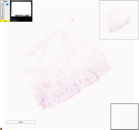 Svs To Tiff Conversion Issue 1838 Libvips Libvips GitHub