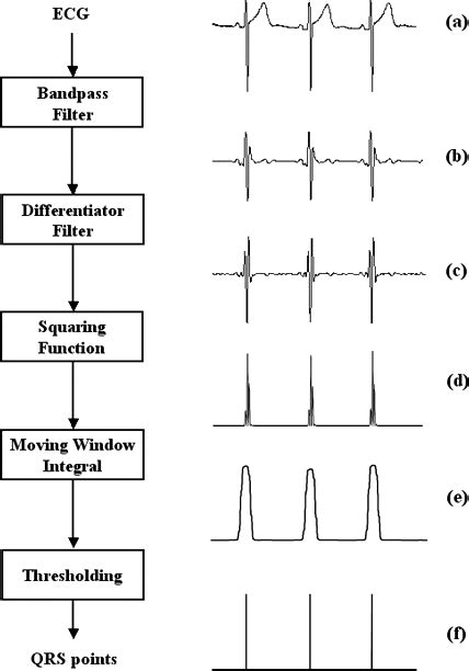 5 Block Diagram With The Respective Expected Signals For Qrs