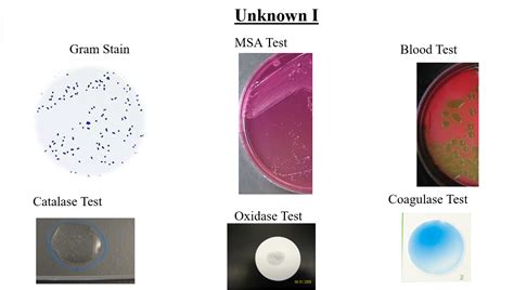 Steps For Identification Of Unknown Bacteria Lab Chegg Com