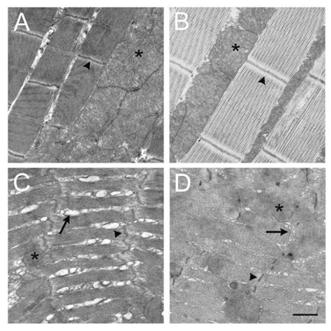 Transmission Electron Microscopy Of Wild Type And Happ Expressing