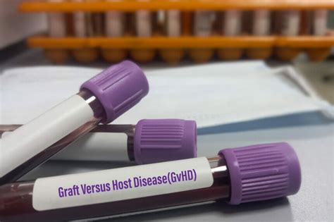 Imbruvica Approved For Pediatric Patients With Chronic Graft Vs Host