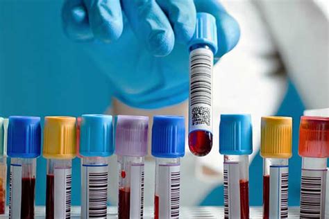 Routine Laboratory Testing In Temecula Ocean Pacific Integrative Health Center