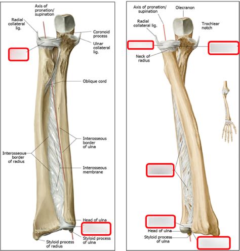 Distal Radioulnar Joint Anatomy