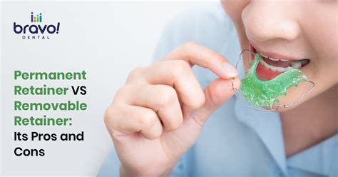 Permanent Retainer VS Removable Retainer Its Pros And Cons Bravo Dental Dallas