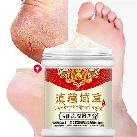 皲裂怎么读 皲裂膏 随意云