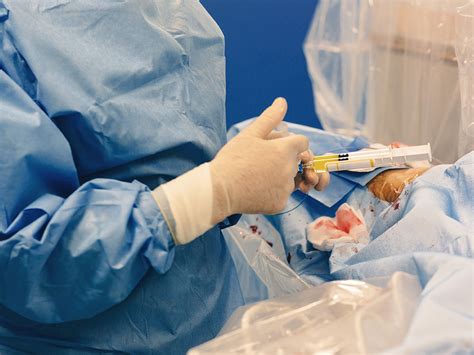 Laparoscopic Management Of Uterine Fibroids Gynecologist