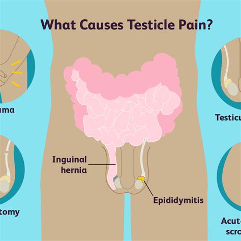 Why Is My Testicle Not Working At Patrick Ross Blog
