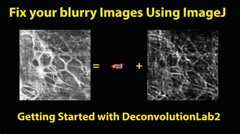 Fiji Imagej Plugin Color Deconvolution Ressarmor