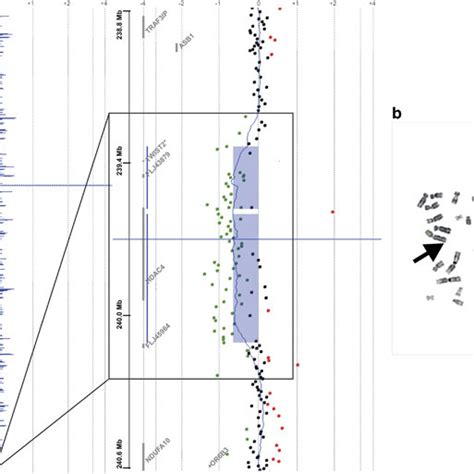 Array Cgh Profile Of Chromosome 2 Indicating A Heterozygous
