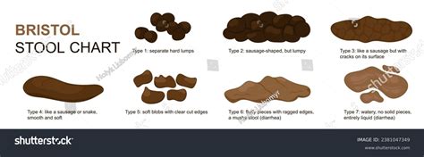 Bristol Stool Scale Stool Types Infographic Vetor Stock Livre De