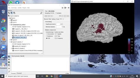Epileptogenicity Maps Errors When Resampling Stat Results Discussions Brainstorm