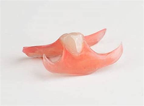 Replace Missing Teeth Houston Tx Dentures Dental Implants