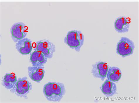 计算机视觉 物体计数 Csdn博客