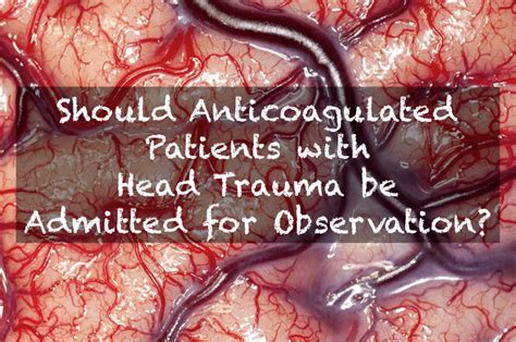 Risk Of Ich In Anticoagulated Patients Rebel Em Emergency Medicine Blog