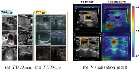 Figure 2 From An Attention Based Semi Supervised Neural Network For