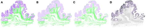figure 3 from deep convolutional neural network based lymph node
