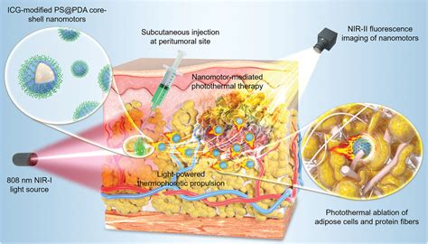 Nir‐ii Fluorescent Thermophoretic Nanomotors For Superficial Tumor Photothermal Therapy Jiang
