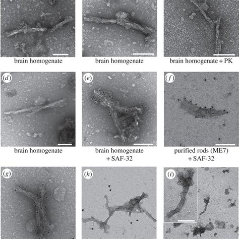 Visualization Of Prp Rods In Crude Rml Brain Homogenate In Total 10