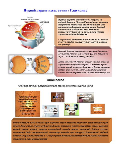 Талимаа эмнэлэг ТАЛИМАА ЭМНЭЛЭГ НЬ НҮДНИЙ ДАРАЛТ ИХСЭХ
