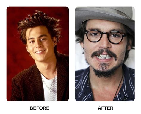 Johnny Depp Teeth The Shocking 2026 Transformation Before And After