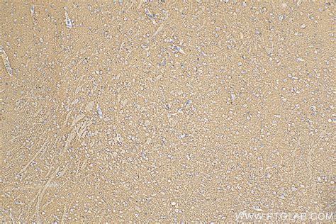 Synaptophysin Antibody 67864 1 Ig Proteintech