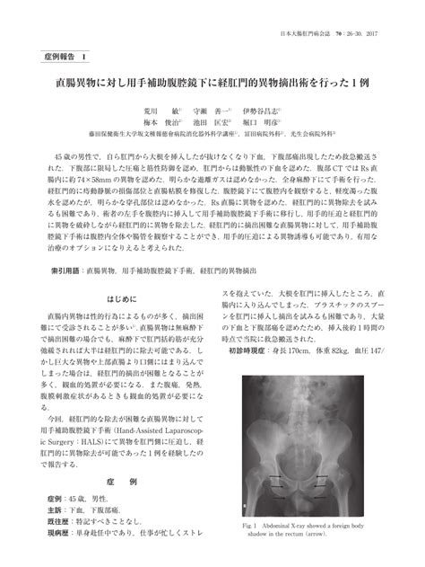 Pdf A Case Of Transanal Extraction Of A Foreign Body In The Rectum Using Hand Assisted
