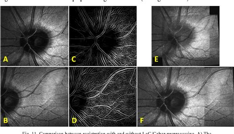 Figure 1 From Handheld Simultaneous Scanning Laser Ophthalmoscopy And Optical Coherence