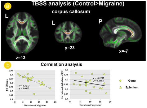 A Tract Based Spatial Statistics Tbss Analysis Revealed Decreased Download Scientific