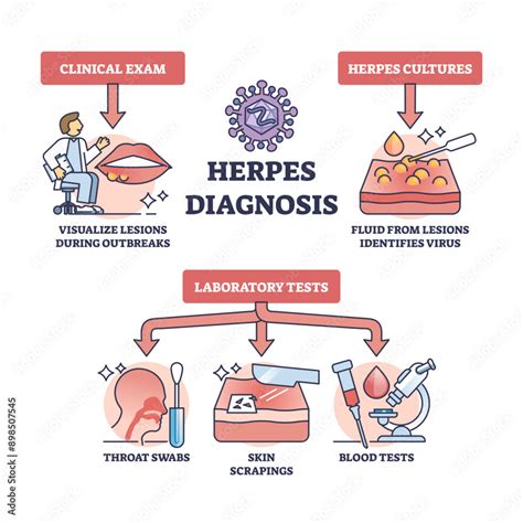 Herpes Diagnosis And Hsv Virus Medical Diagnosis Methods Outline
