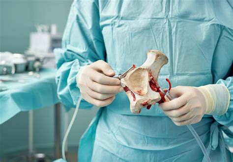 Effective Management Of Bone Defects After Tumor Resection