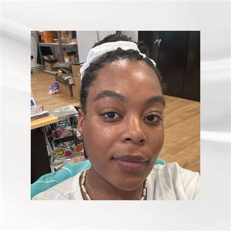 10 Best Dandruff Treatments To Keep My Scalp Flake Free Marie Claire