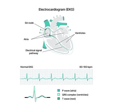 Ecg Vs Ekg Difference Between Electrocardiogram Ekg And Ecg