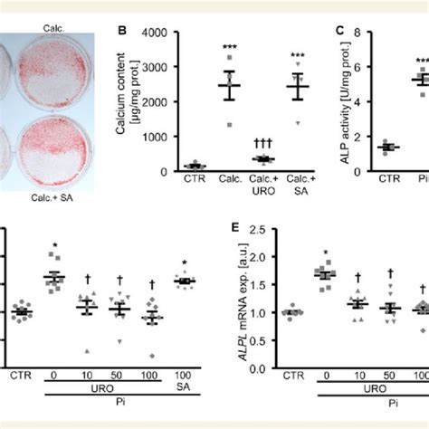 Serum Uromodulin Levels Inversely Associate With Serum Calcification