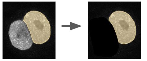 Segment The Active Volume Development 3d Slicer Community