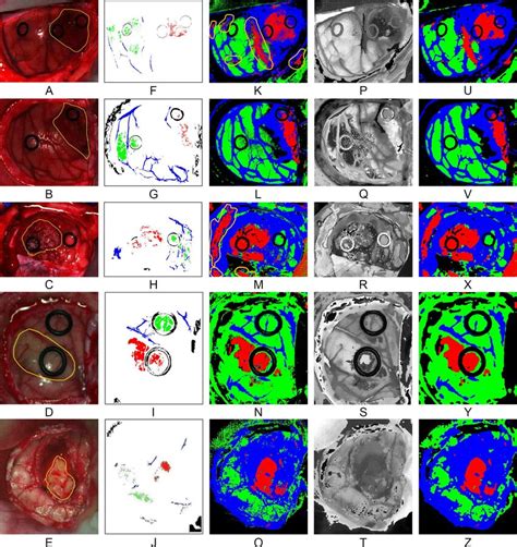 Results Of Each Step Of The Optimized Spatial Spectral Supervised Download Scientific Diagram