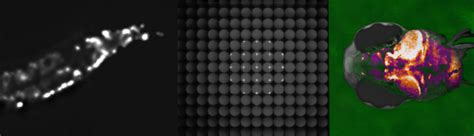 Simultaneous Whole Brain Functional Imaging Of Neuronal Activity Using Light Field Microscopy