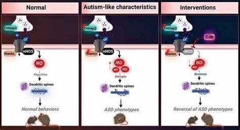 Nồng độ Oxit Nitric Là Nguyên Nhân Có Thể đảo Ngược Chứng Rối Loạn Phổ