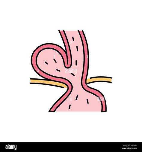 Hiatal Hernia Olor Line Icon Pictogram For Web Page Mobile App Promo Ui Ux Gui Design