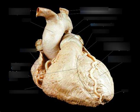 Heart Cadaver Diagram Quizlet