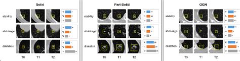 Figure 2 From Siamese Encoder Based Spatial Temporal Mixer For Growth Trend Prediction Of Lung
