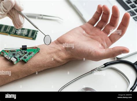 Hand With Implantation Of Micro Chip X Ray View Close Up Chipization Of People Control