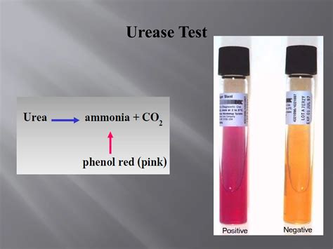 Urease Testpptx Microbiology Hematology Pptx Infectious Diseases