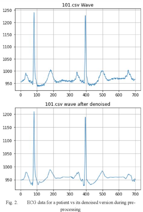 Figure 2 From Classification Of Arrhythmia Using Transfer Learning And Its Applications In Smart