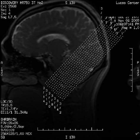 File Slices Psych 221 Image Systems Engineering