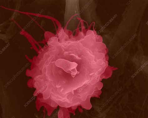 Apoptotic Muscle Cell Sem Stock Image C032 0161 Science Photo Library