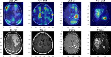 the importance of explainable ai xai in computer vision a data odyssey