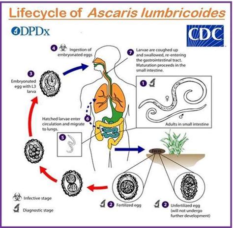Ascariasis Causes Treatment Prevention We Care