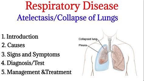 Atelectasis Introduction Causes Signs Andsymptoms Diagnosis And Treatment Respiratory