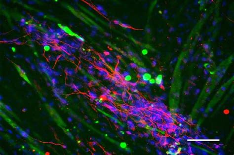 New Technique Generates Human Neural Stem Cells For 3d Brain Models And Tissue Engineering