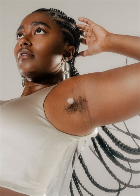 Ingrown Microdart Patch Ingrown Hair Patches Fur